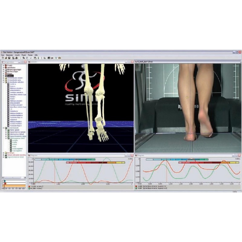 System diagnostyki układu kostno-szkieletowego Simi MOTION TWIN