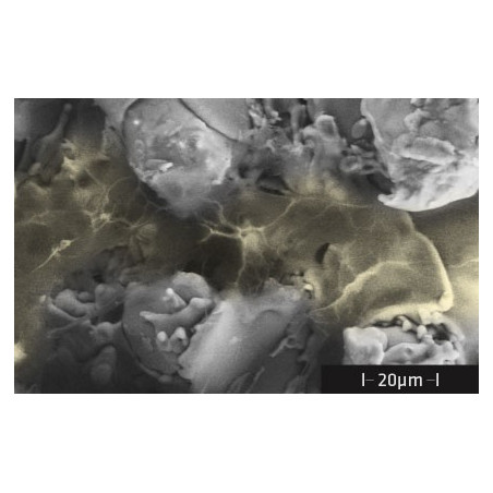 Implant do całkowitej wymiany dysku odcinka lędźwiowego